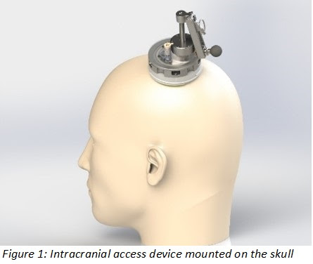 Collaboration yields innovative devices for rapid treatment of brain ...
